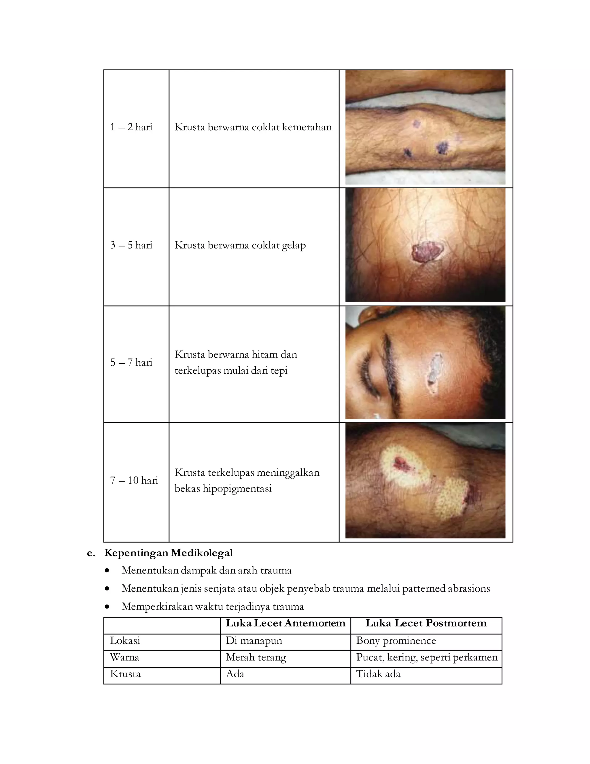 Forensik - Traumatologi | DOCX