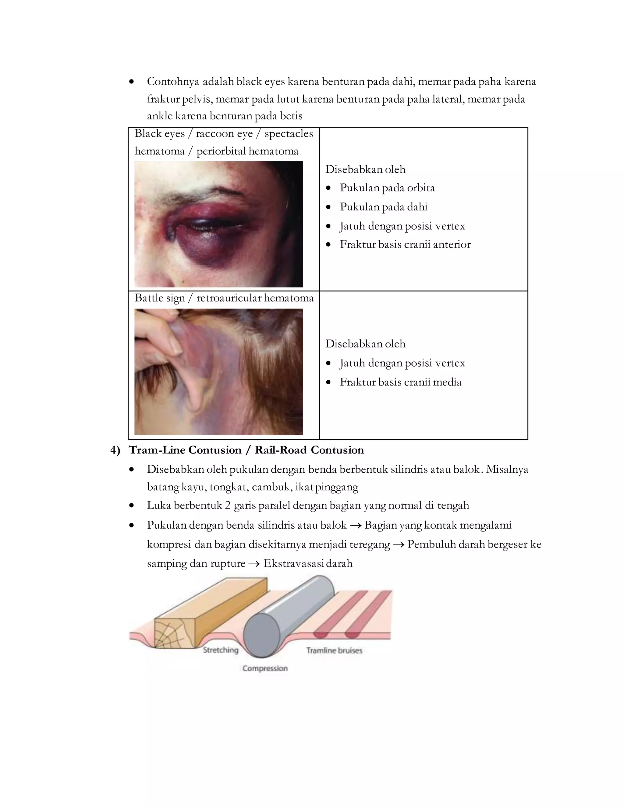 Forensik - Traumatologi | DOCX
