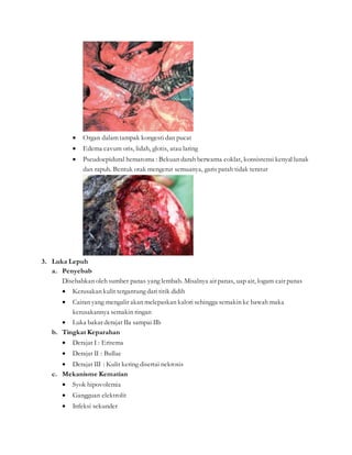 Forensik - Traumatologi | DOCX