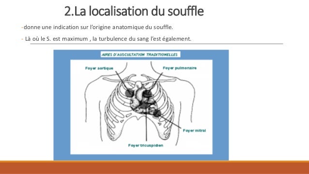 Cat devant un souffle cardiaque