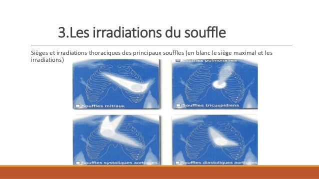 Cat devant un souffle cardiaque