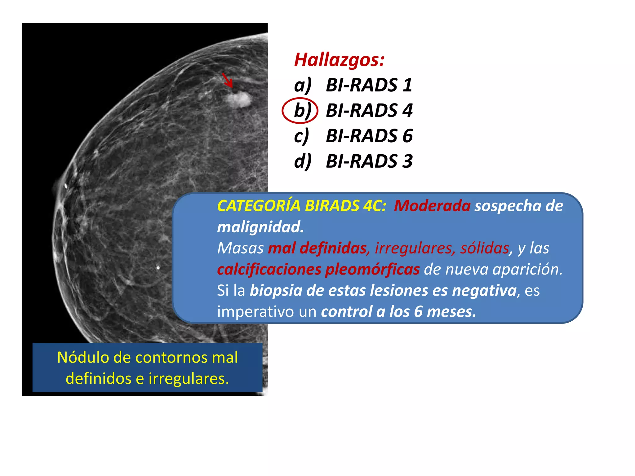 Categorías bi rads en los informes mamográficos | PPTX