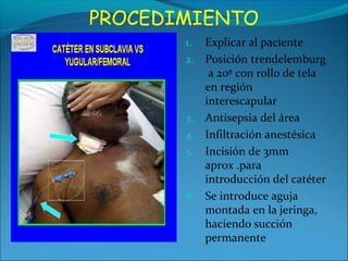 Cateter Venoso Central | PPT