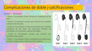 cateter doble J.pptx