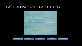 Colocación catéter doble J urología..... | PPTX