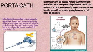 Cateter implantable Porta Cath.pptx
