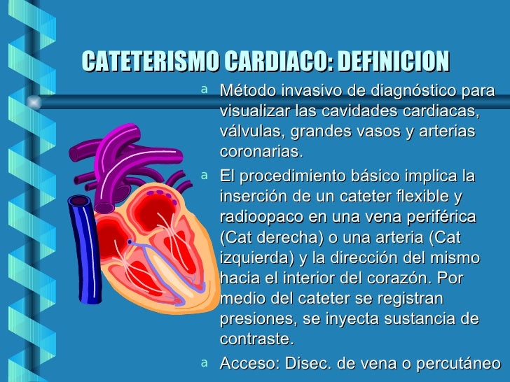 Cateterismo cardiaco