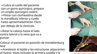 cateterismo venoso central, generalidades, tecnica | PPTX