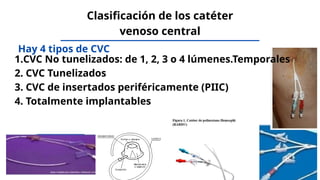 cateterismo venoso central, generalidades, tecnica | PPTX