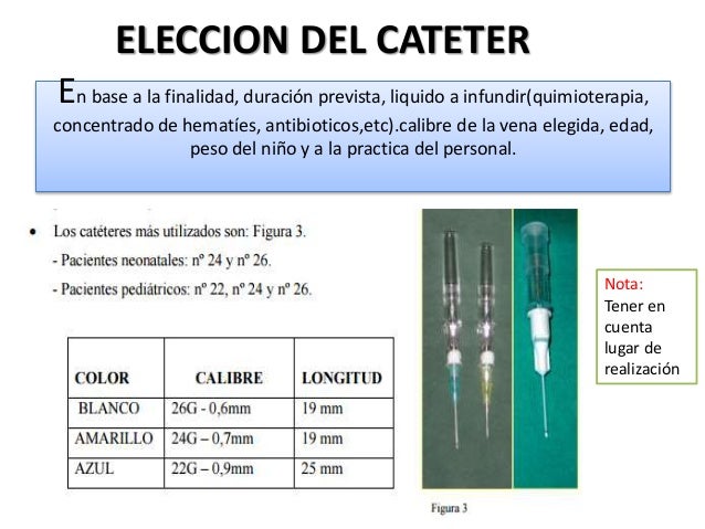 Cateterizacion