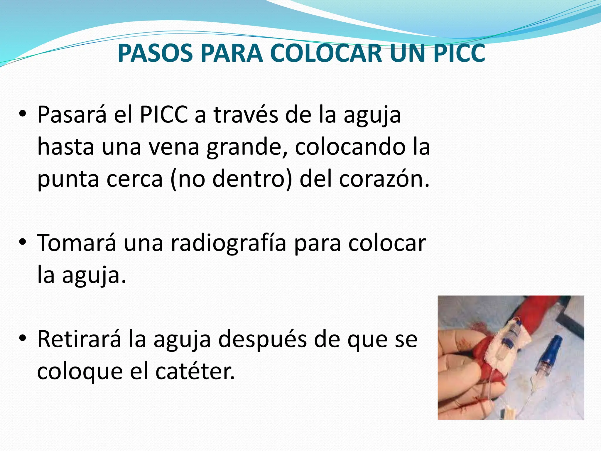 CATETER PICC NEONATAL Texnica y procedimientoB.pptx