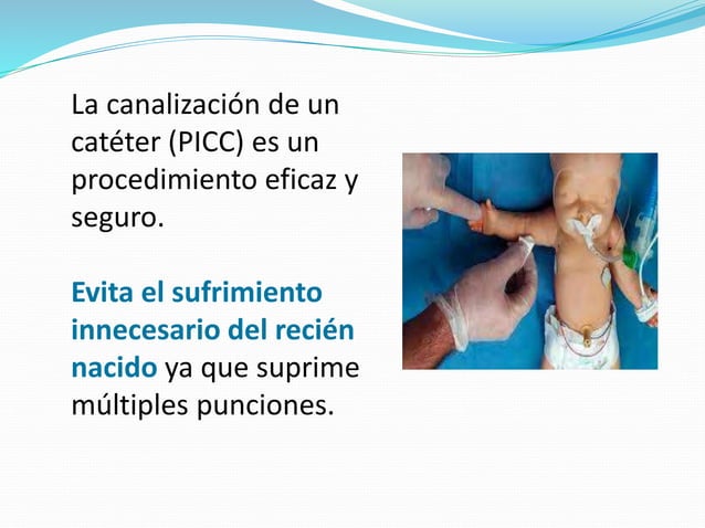 CATETER PICC NEONATAL Texnica y procedimientoB.pptx