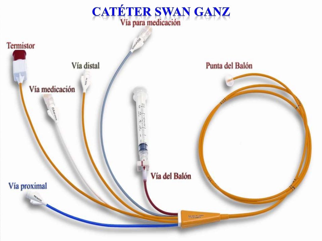 Cateter swan ganz actual