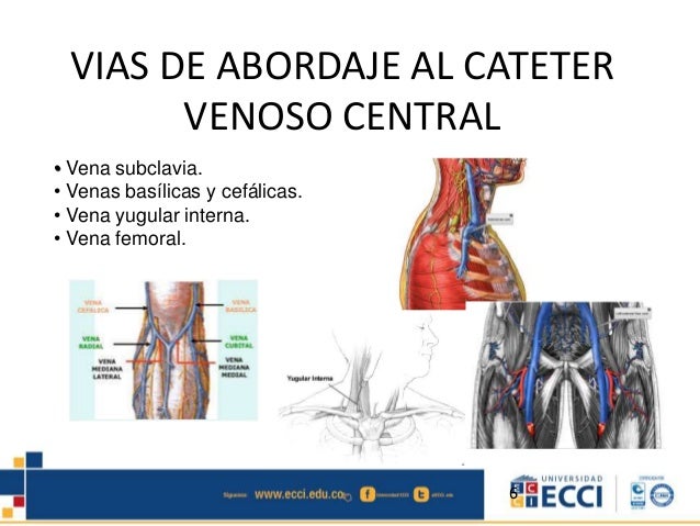 Cateter venoso central