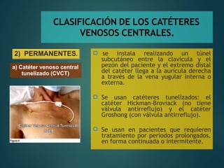 Cateter Venoso Central CURACION MANEJO Y MANTENIMIENTO | PPTX