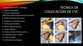 COLOCACION DE CATETER VENOSO CENTRAL-convertido.pptx
