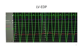 CATH MEET: POST GLENN FOR RAISED PA PRESSURES | PPTX