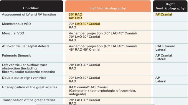 LV angiography.pptx | Heart and Cardiovascular Diseases | Diseases and ...