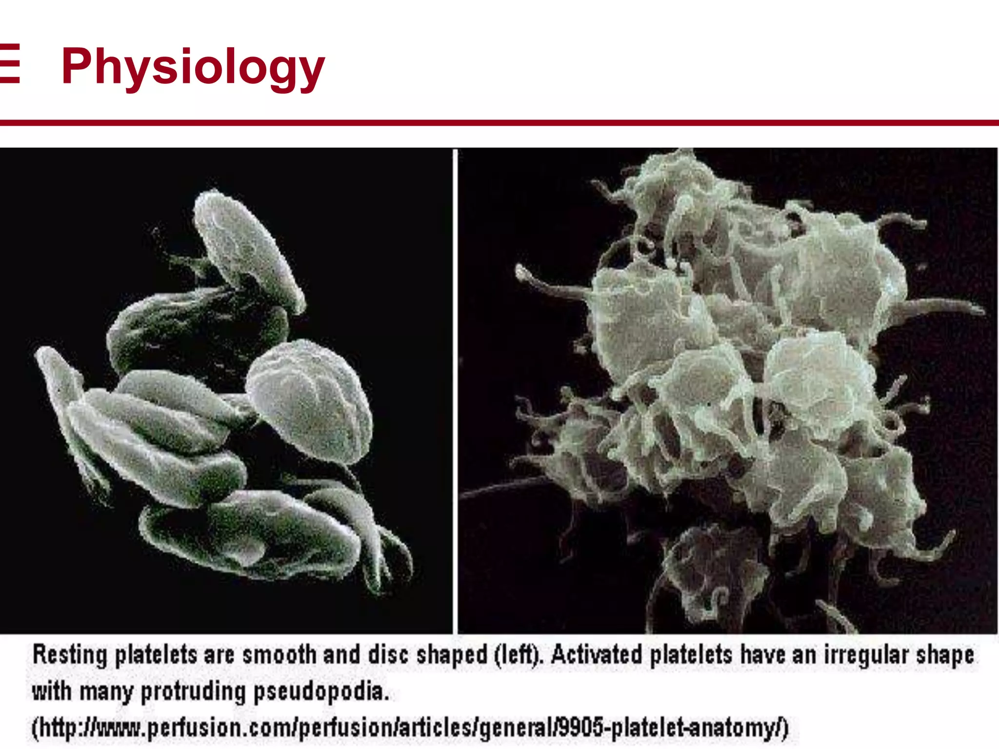 Catheter Related Thrombus Management (enhanced by VisualBee) | PPTX