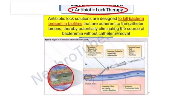 CATHETER-RELATED BLOOD STREAM INFECTION (CRBSI).pptx