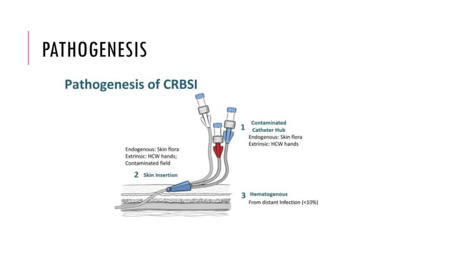 CATHETER-RELATED BLOOD STREAM INFECTION (CRBSI).pptx