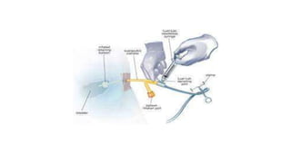CATHETER-SPECIMEN-OF-URINE.pptx