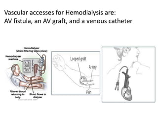 Catheter access final | PPTX