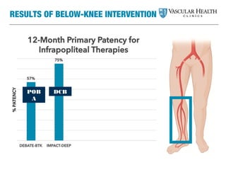 Catheter Based Intervention and Surgical Management of Peripheral ...