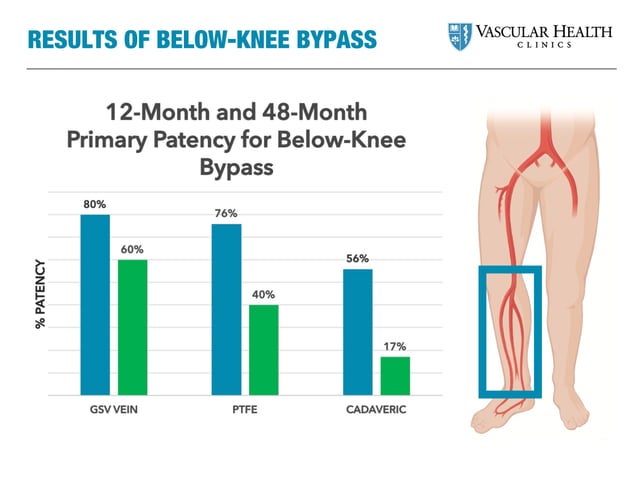 Catheter Based Intervention and Surgical Management of Peripheral ...