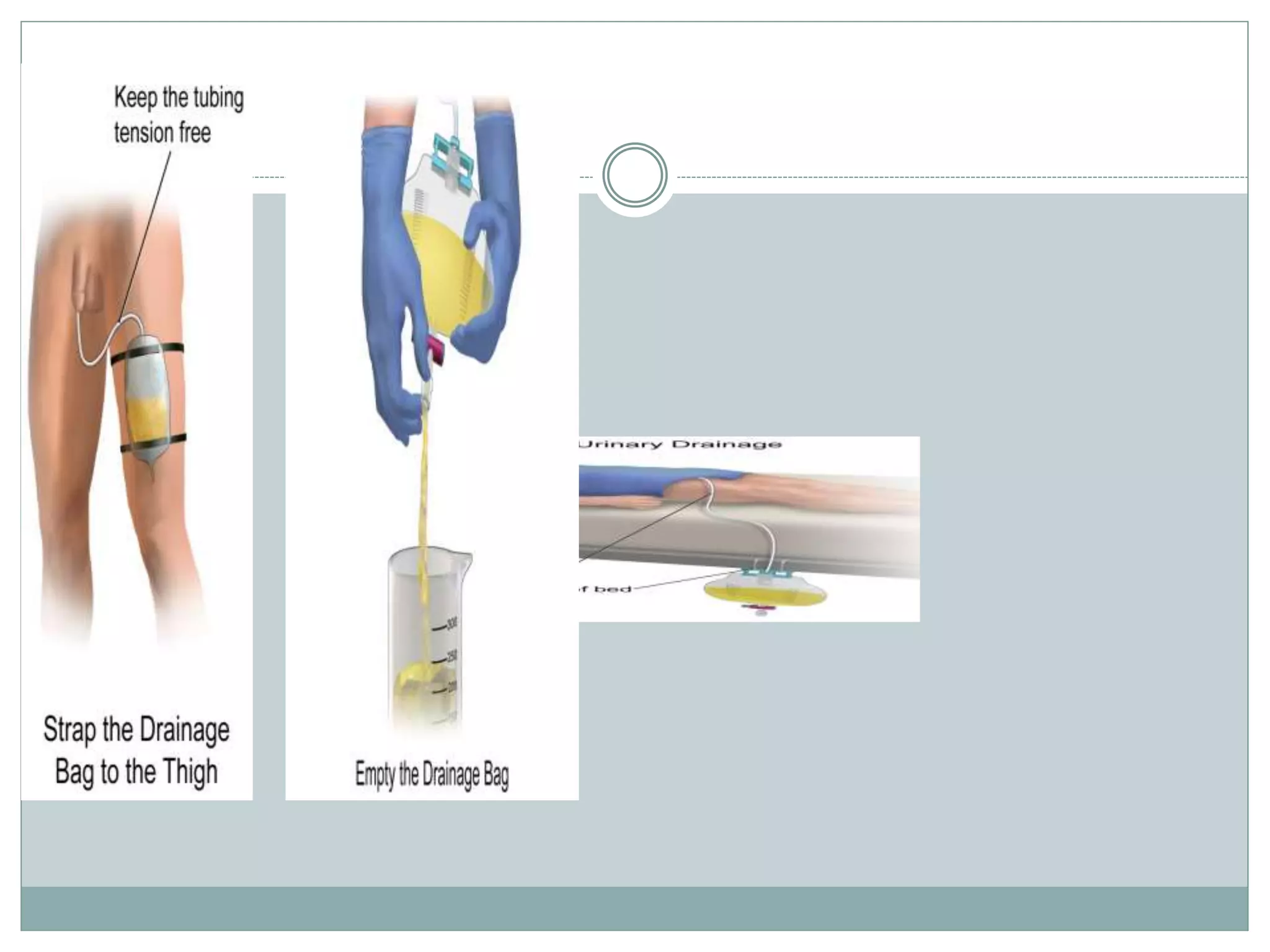 Catheterisation | PPTX | First Aid | Injuries