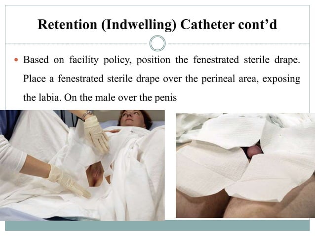 Catheterization.pptx