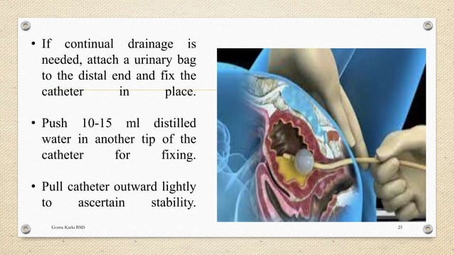 Urinary Catheterization(Definition, indication, types, procedure).pptx ...