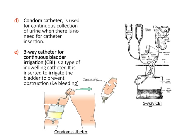 Catheterization Procedure for Childs and Adults | PPTX