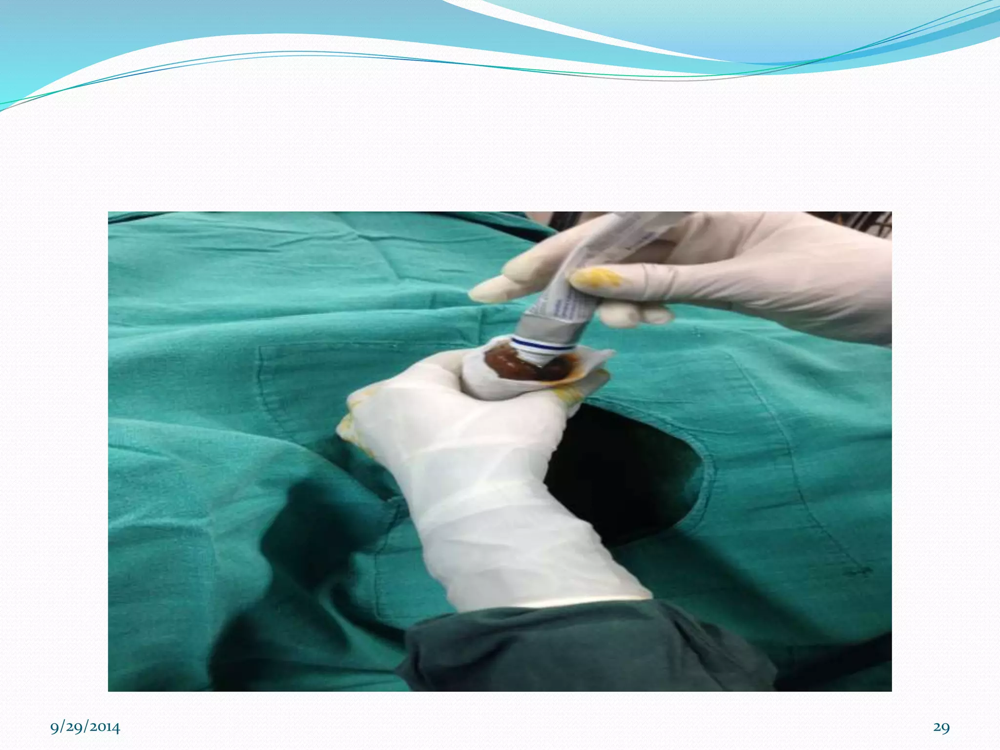 URINARY CATHETER SKILLS AND CARE: DR SWAPNIL TOPLE, DNB UROLOGY | PPTX