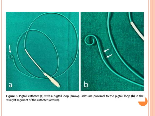 diagnostic and guiding catheters Presentation.pptx | Heart and ...
