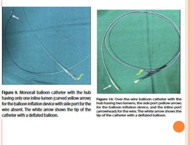 diagnostic and guiding catheters Presentation.pptx | Heart and ...