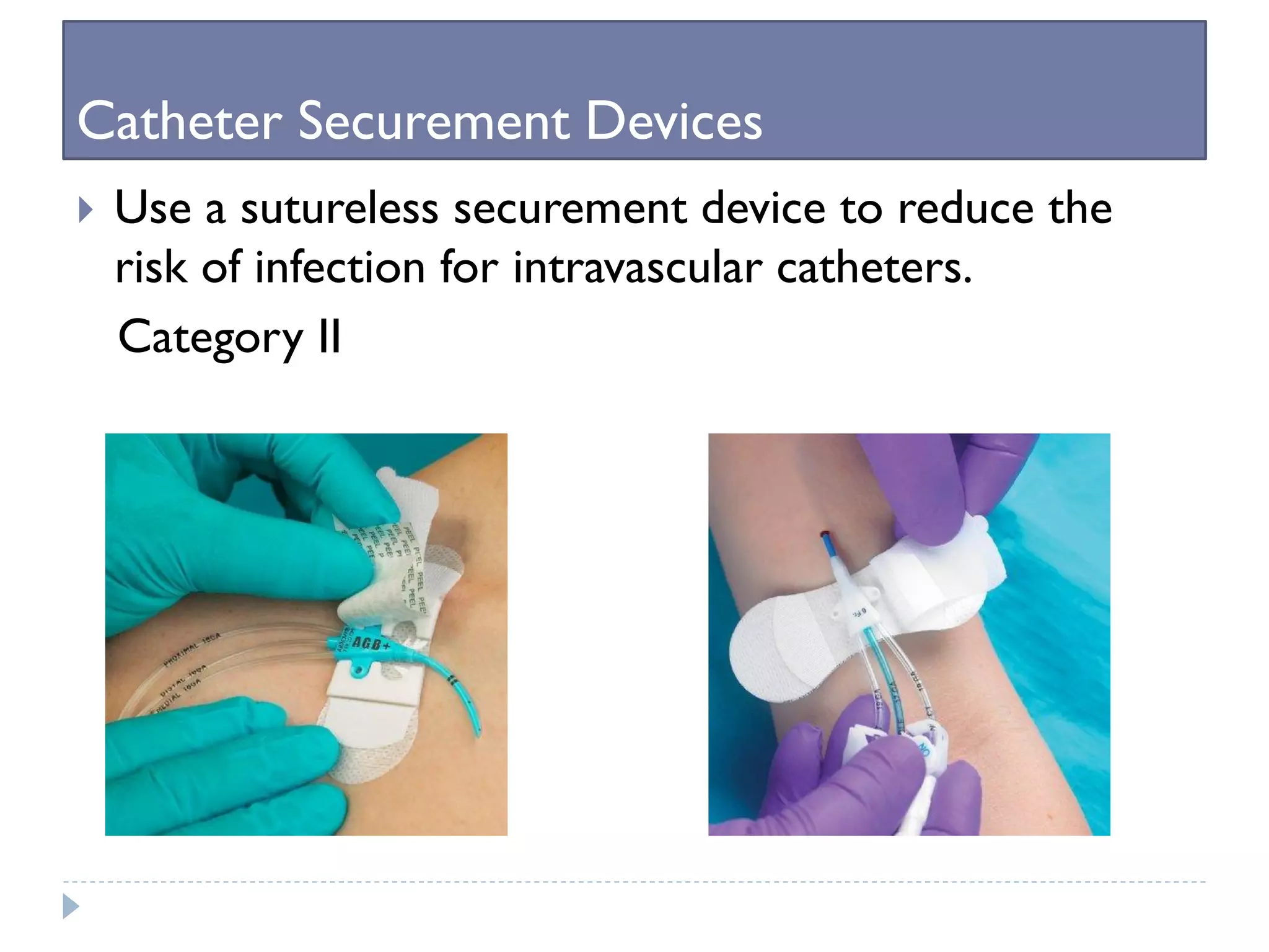 Catheter Related Bloodstream Infection (CRBSI) | PDF