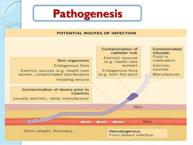 Catheter related _infections .. dr Osama Elshahat