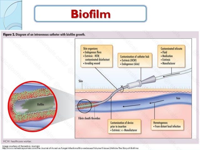 Catheter related _infections .. dr Osama Elshahat