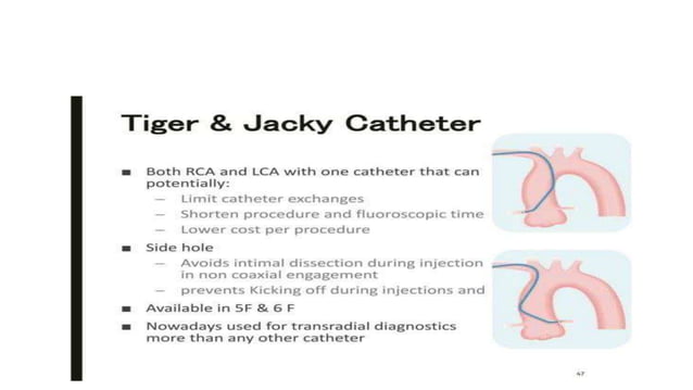 catheters.pptx | Heart and Cardiovascular Diseases | Diseases and ...