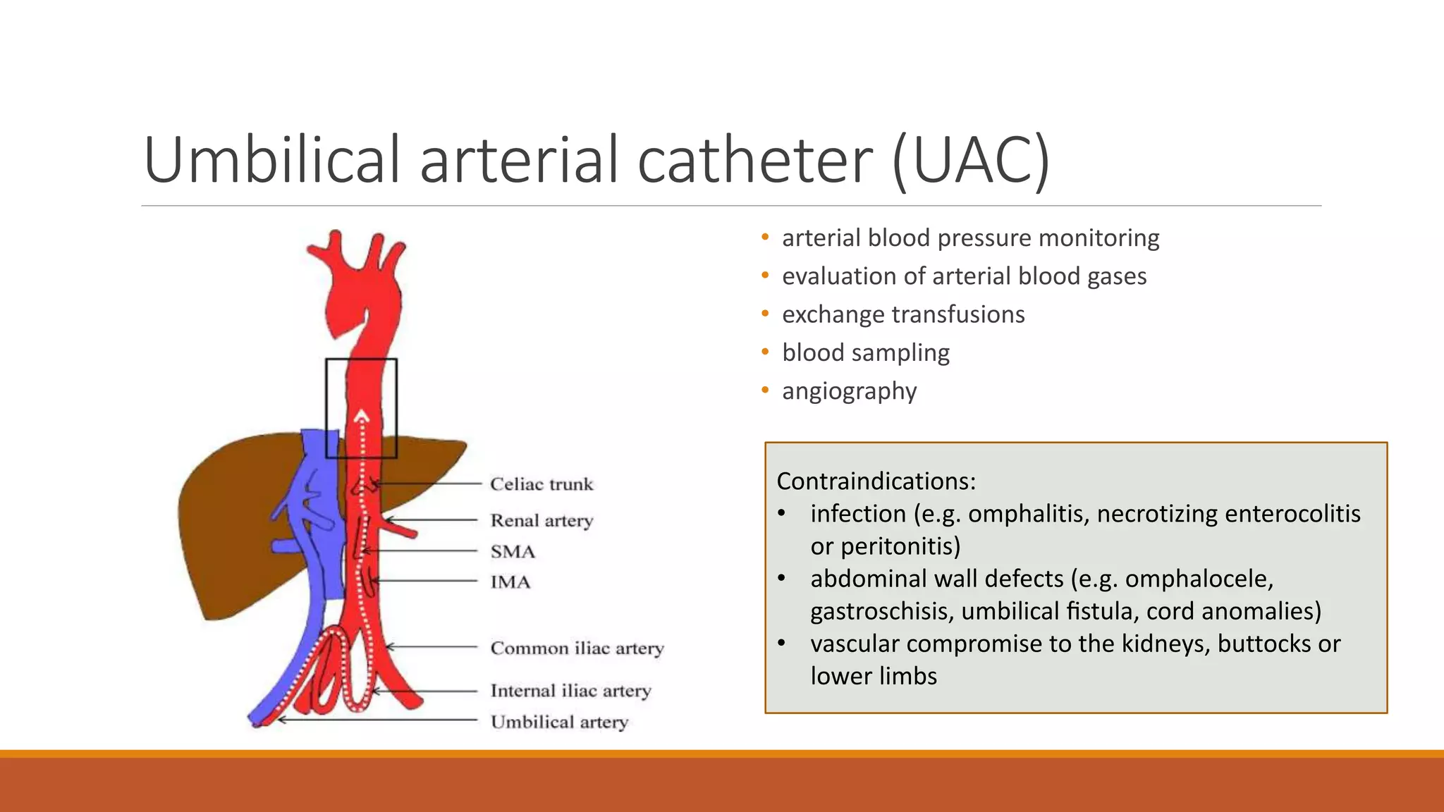 catheters.pptx
