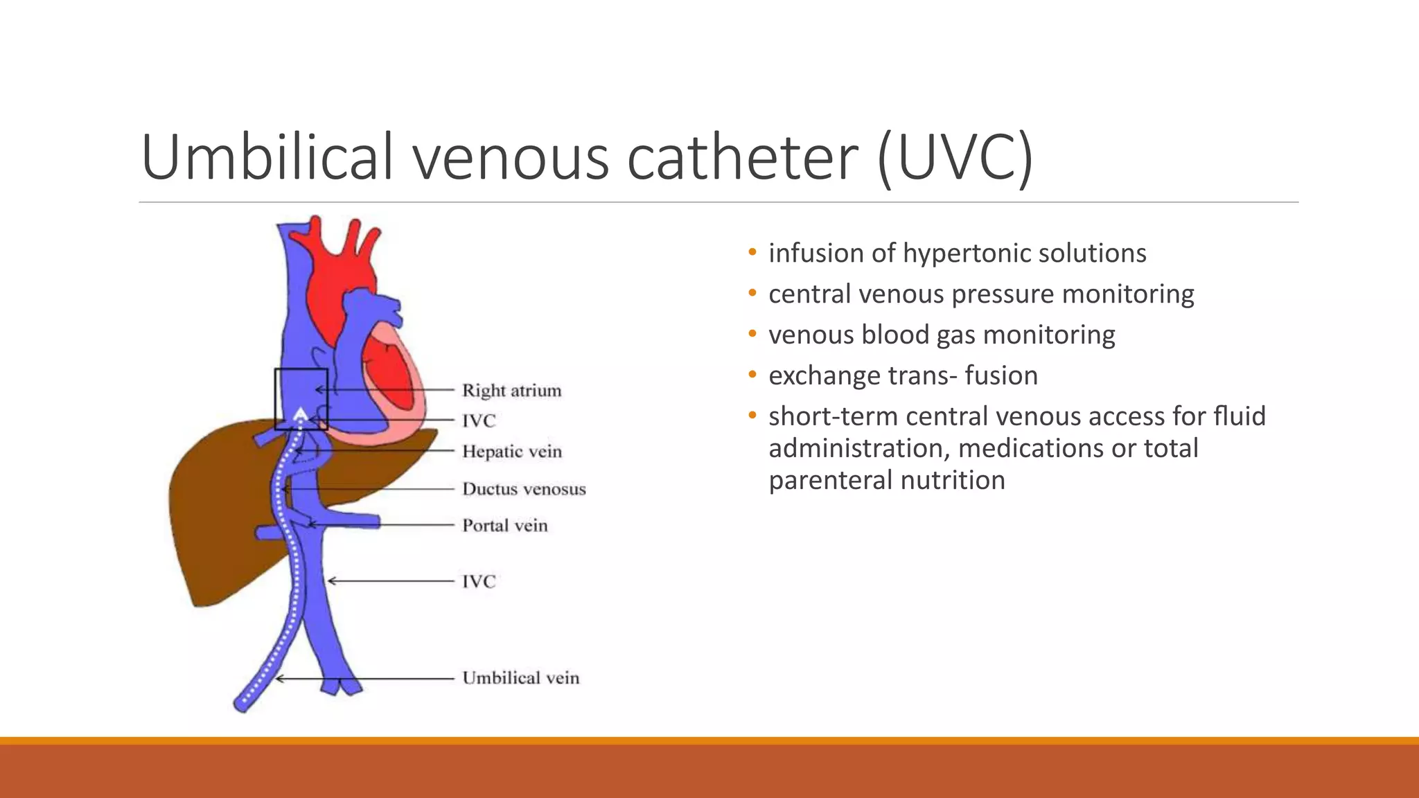 catheters.pptx