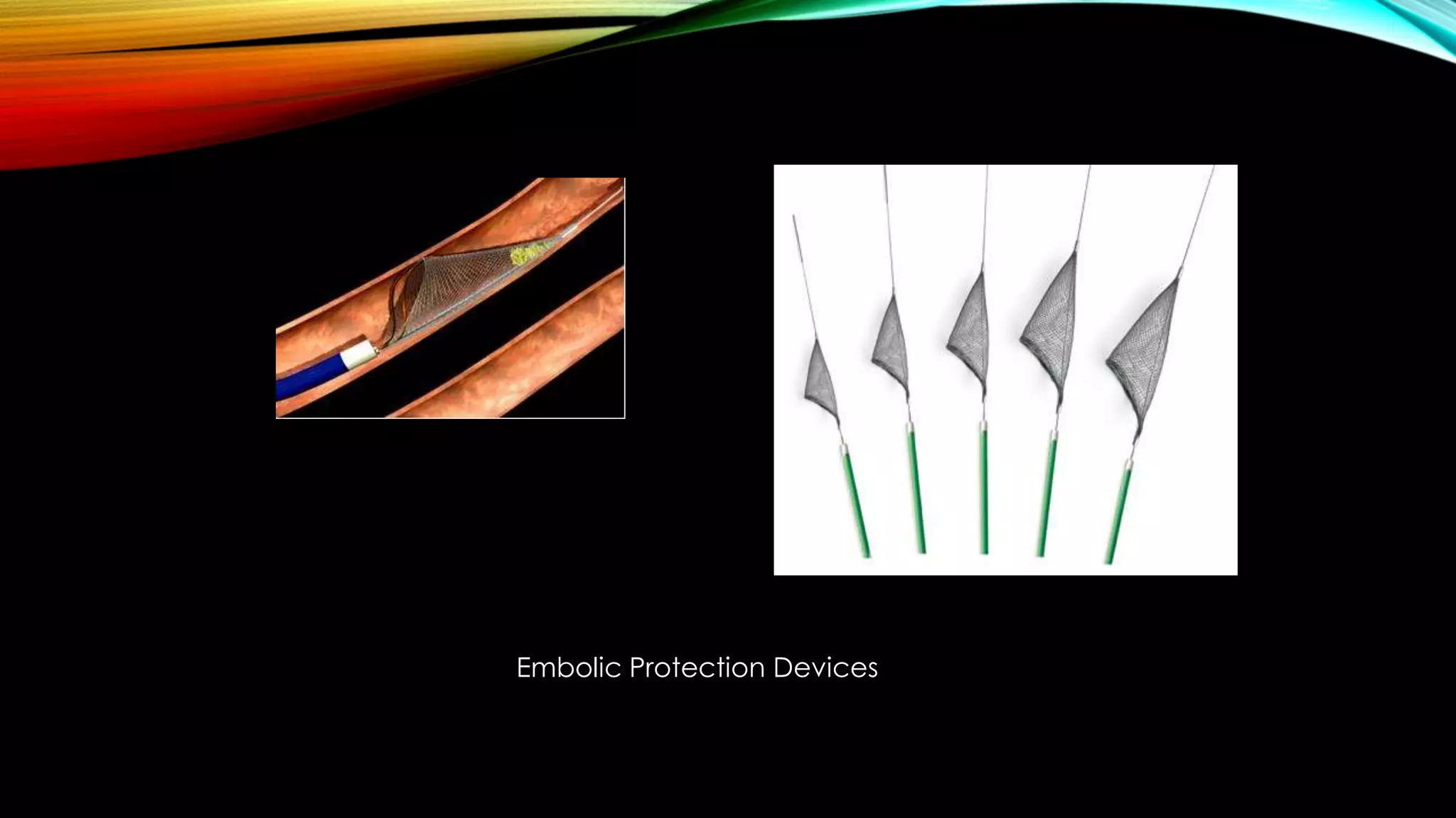 Interventional Radiology : Devices and Embolic Agents that a Resident ...
