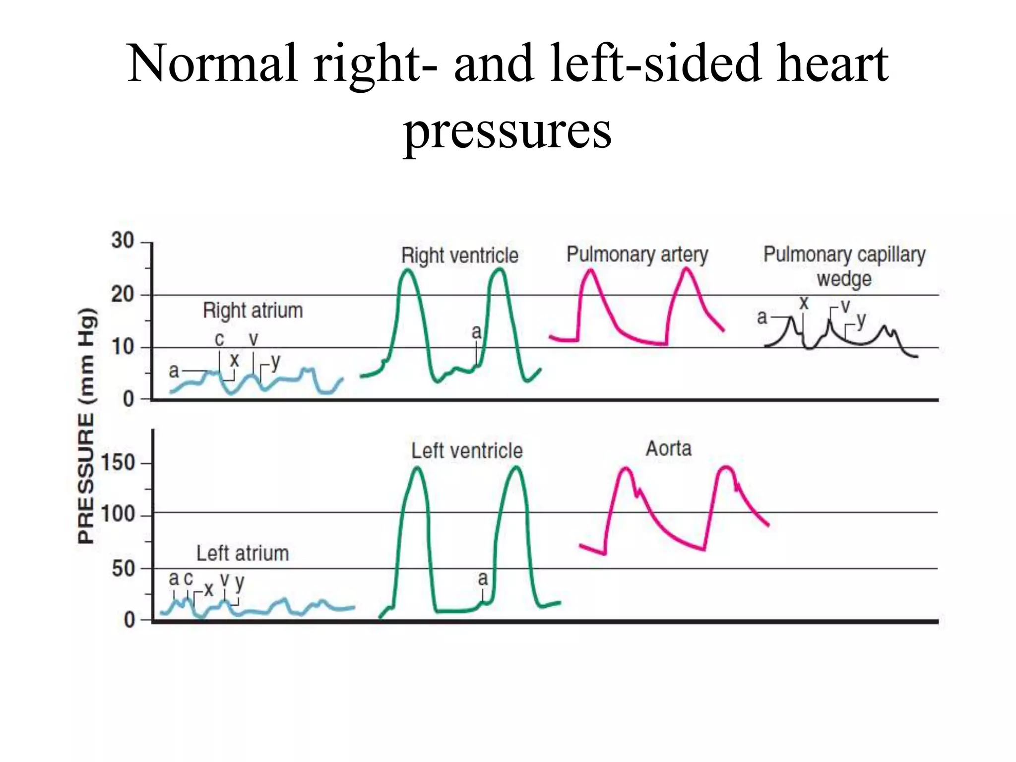 Cath hemodynamics vir | PPTX
