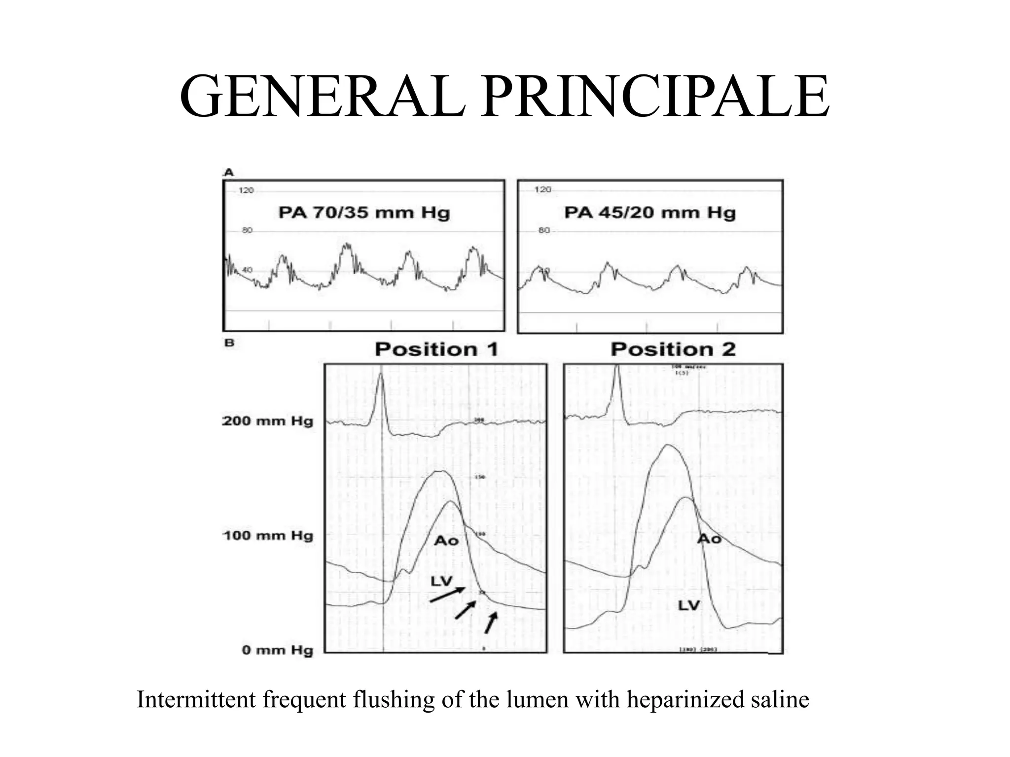 Cath hemodynamics vir | PPTX