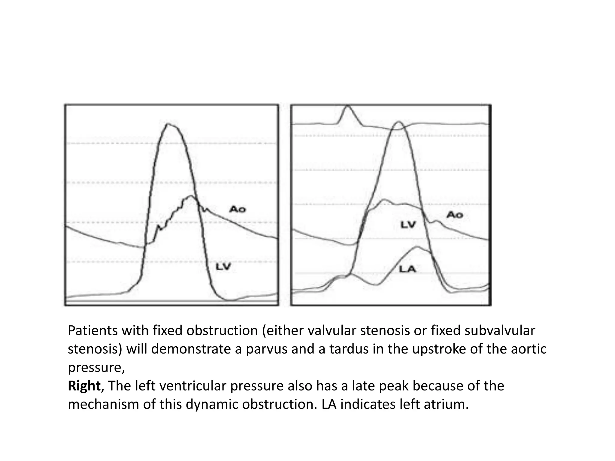 Cath hemodynamics vir | PPTX