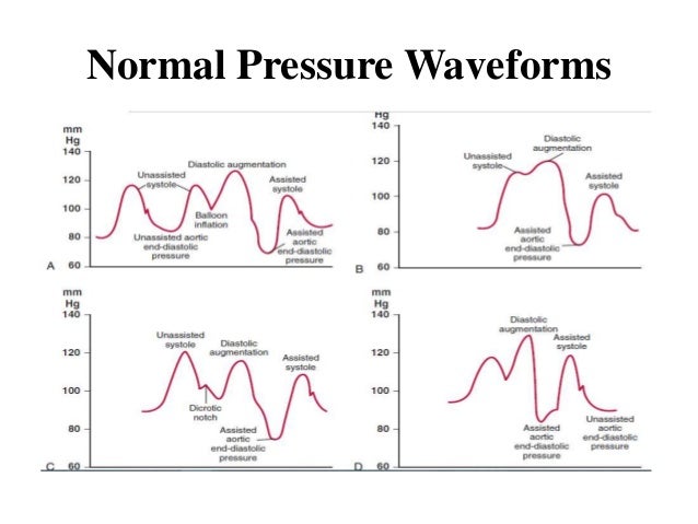 Cath hemodynamics vir
