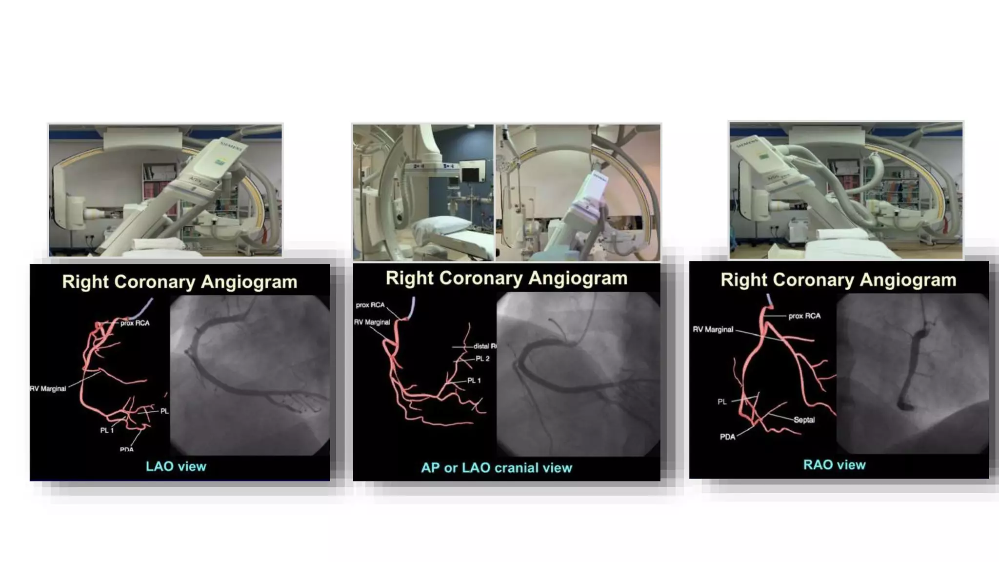 Cardiac Catheterization Laboratory | PPTX