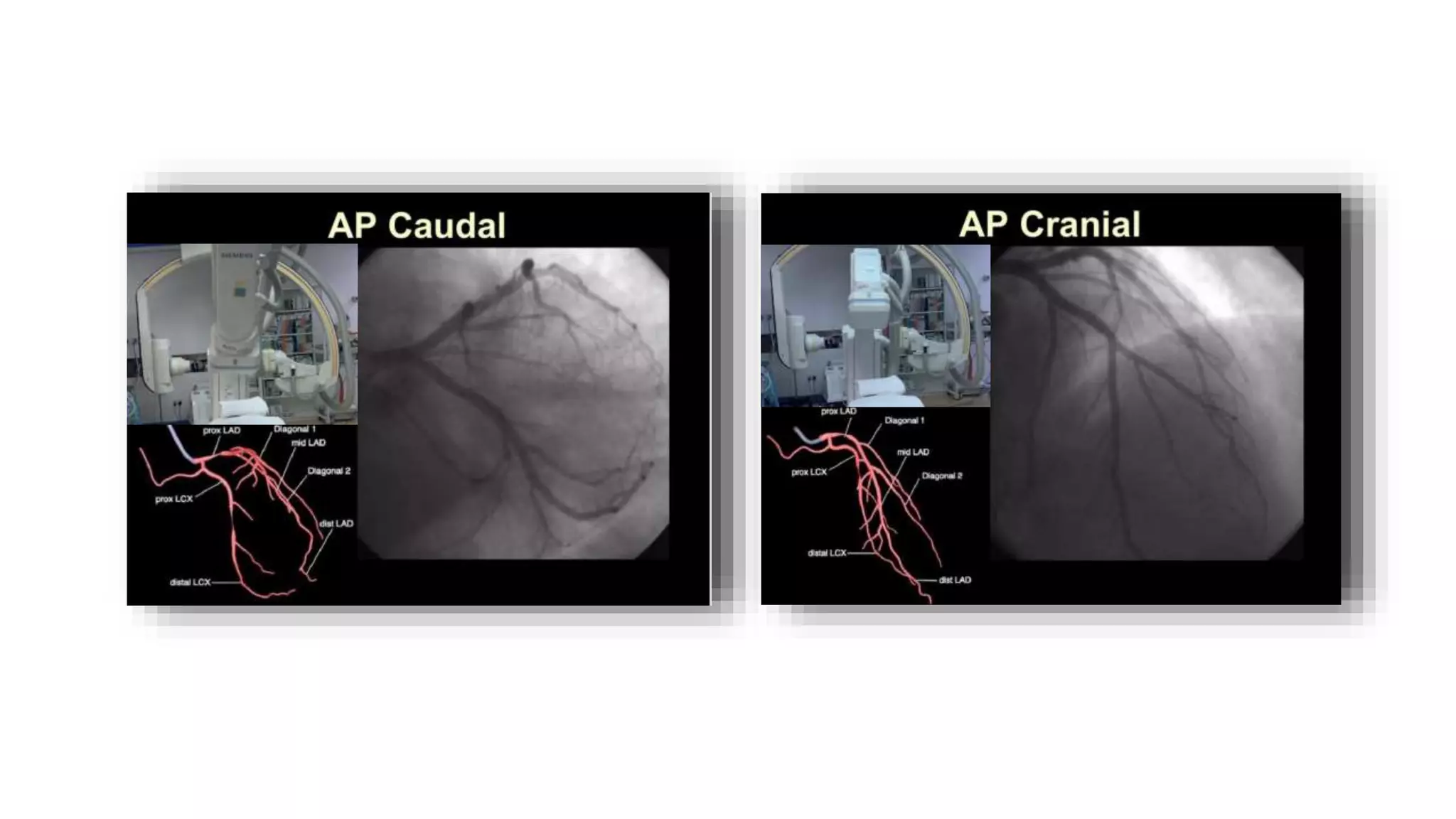 Cardiac Catheterization Laboratory | PPTX