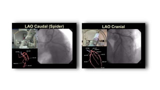 Cardiac Catheterization Laboratory | PPTX